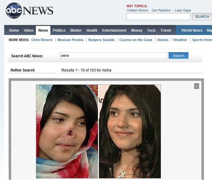 Verminkte Afghaanse Bibi Aisha laat nieuwe gezicht zien | Buitenland ...