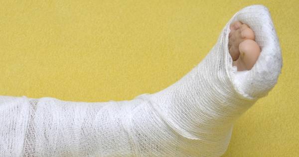 Man rijdt onder invloed met been in het gips | Bizar | AD.nl
