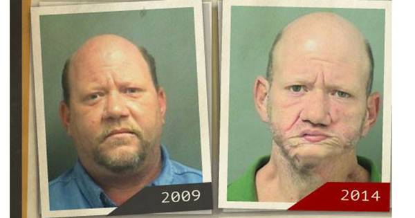 Verslaafden in beeld: de effecten van drugsverslaving | Buitenland | AD.nl