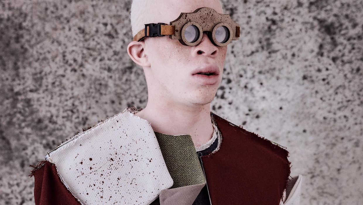 Model Sanele Xaba wil af van taboe op albinisme | Het Parool